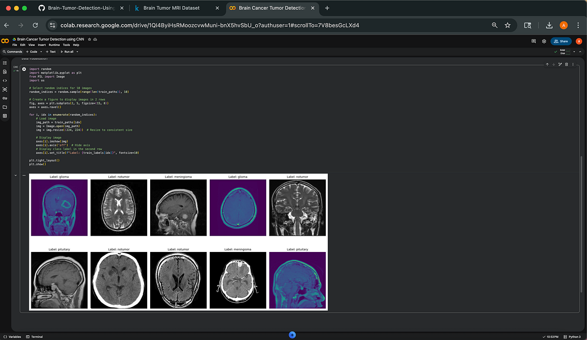 My Journey Building a CNN to detect Tumours (Week of January 12, 2026 ...