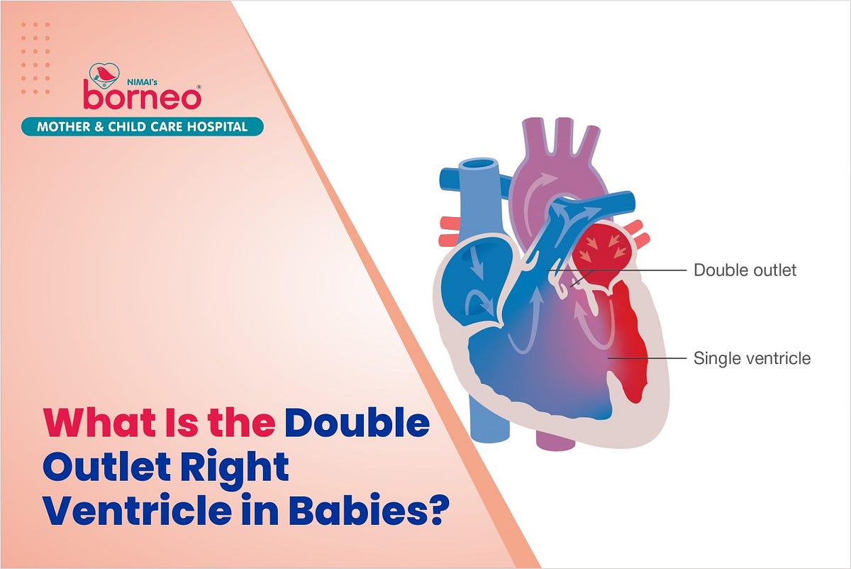 What Is the Double Outlet Right Ventricle in Babies? | by ...