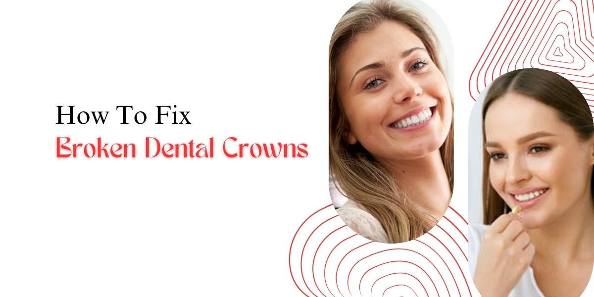 How To Fix Broken Dental Crowns - Emergency Dentist London Pro - Medium