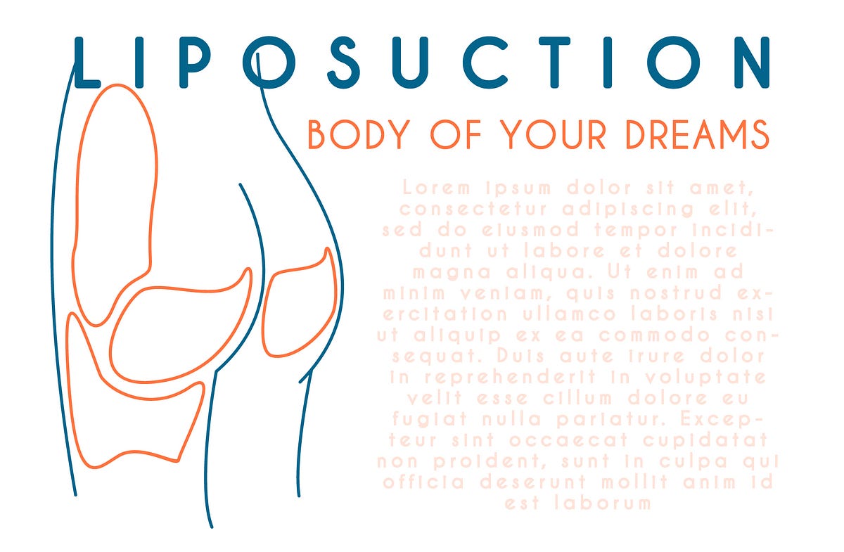 Top Five Frequent Questions about Liposuction | by ...