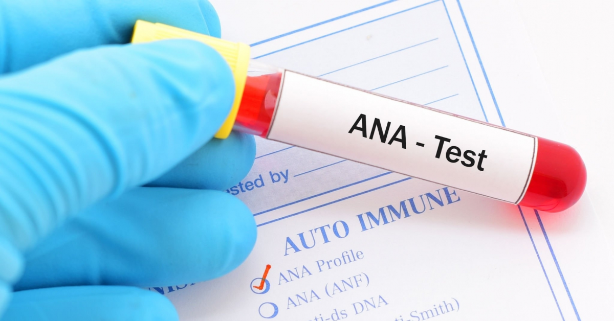 Understanding Antinuclear Antibody (ANA) Test: A Comprehensive Guide ...