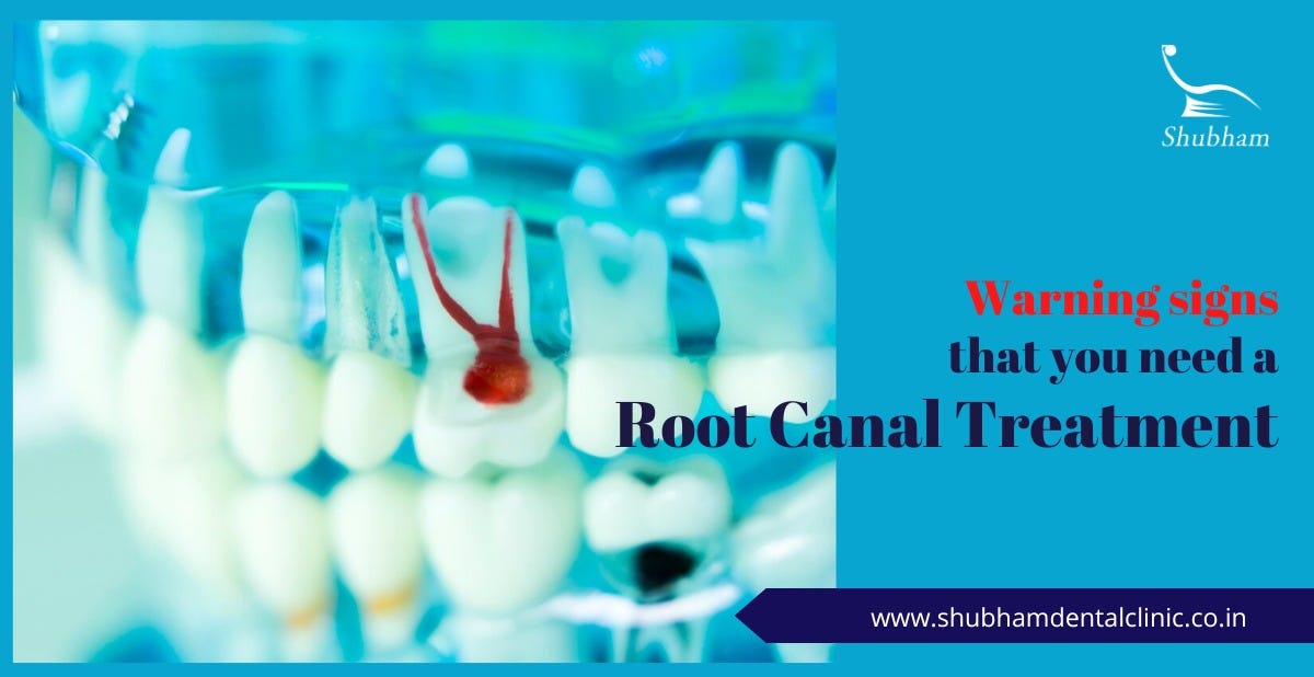 Warning signs that you need root canal treatment | by Dr. Rinku Mittal ...