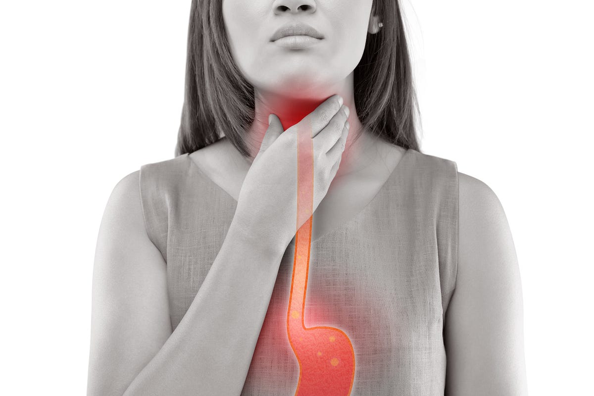 Adjustable Bed Positions For GERD & Acid Reflux | by ergomotion ...