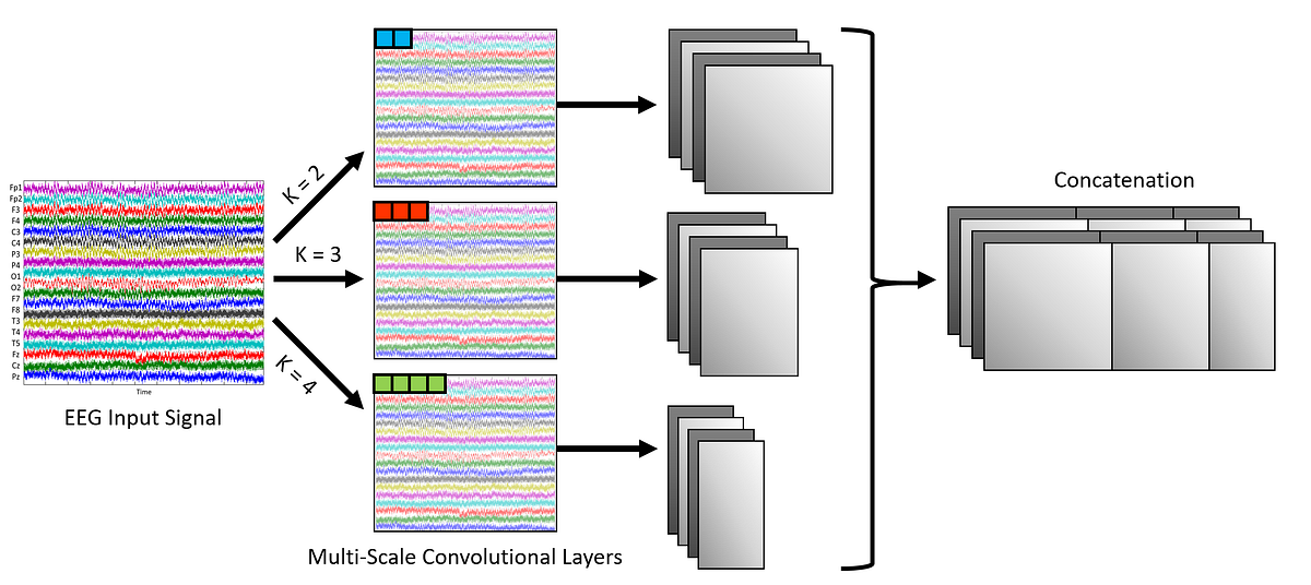 Enhancing Eeg Based Bci Classification With Multi Scale Cnns A Comparative Analysis By Amir