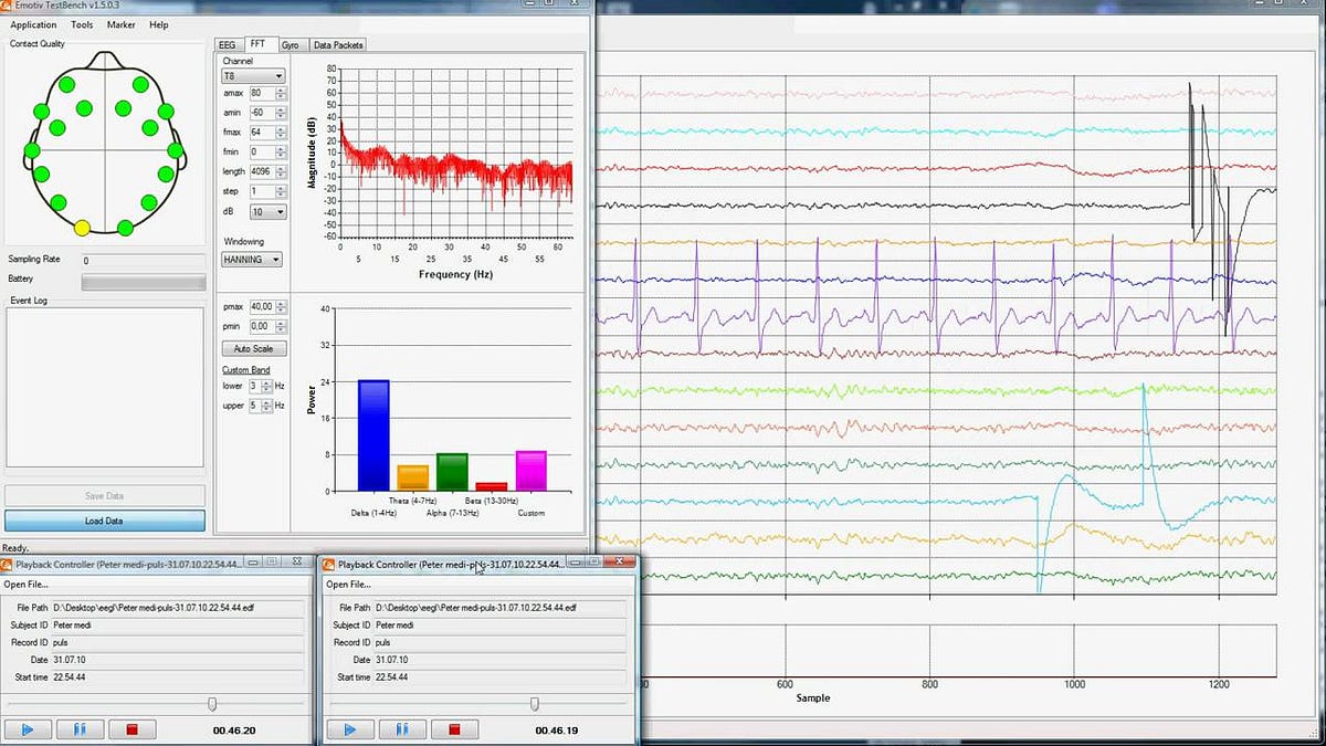 A Brain Sensor Project. This article will lead you through on a… | by ...
