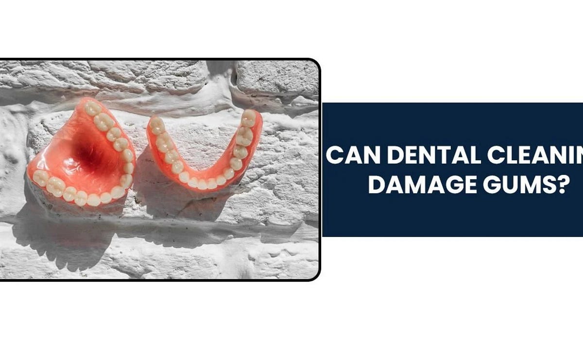Can Dental Cleaning Damage Gums? | Medium
