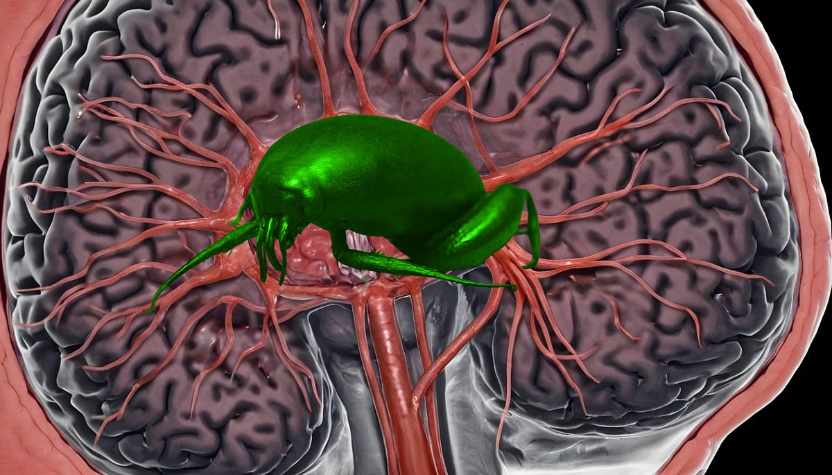 The rich have a parasite in their brain. You have one too but they know ...