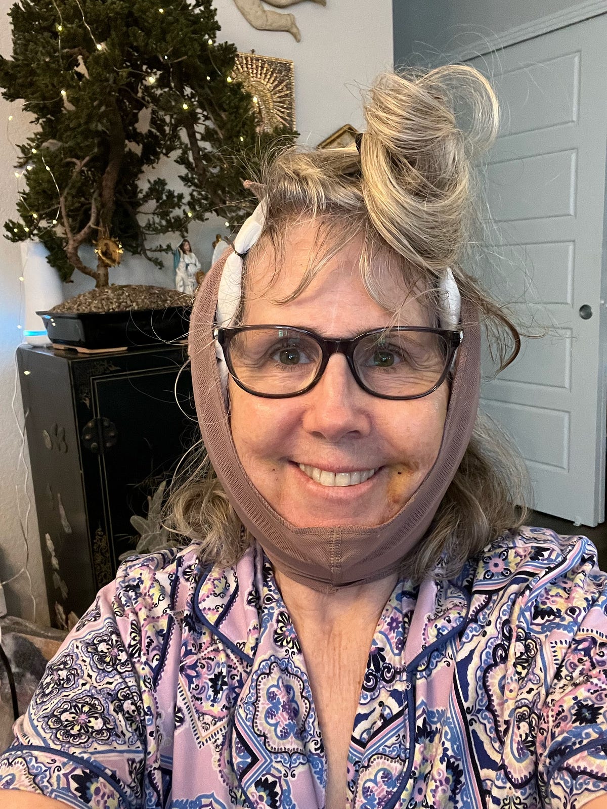 Facelift Recovery: Week One is in the Books | by Shayla Renee 💖 ...