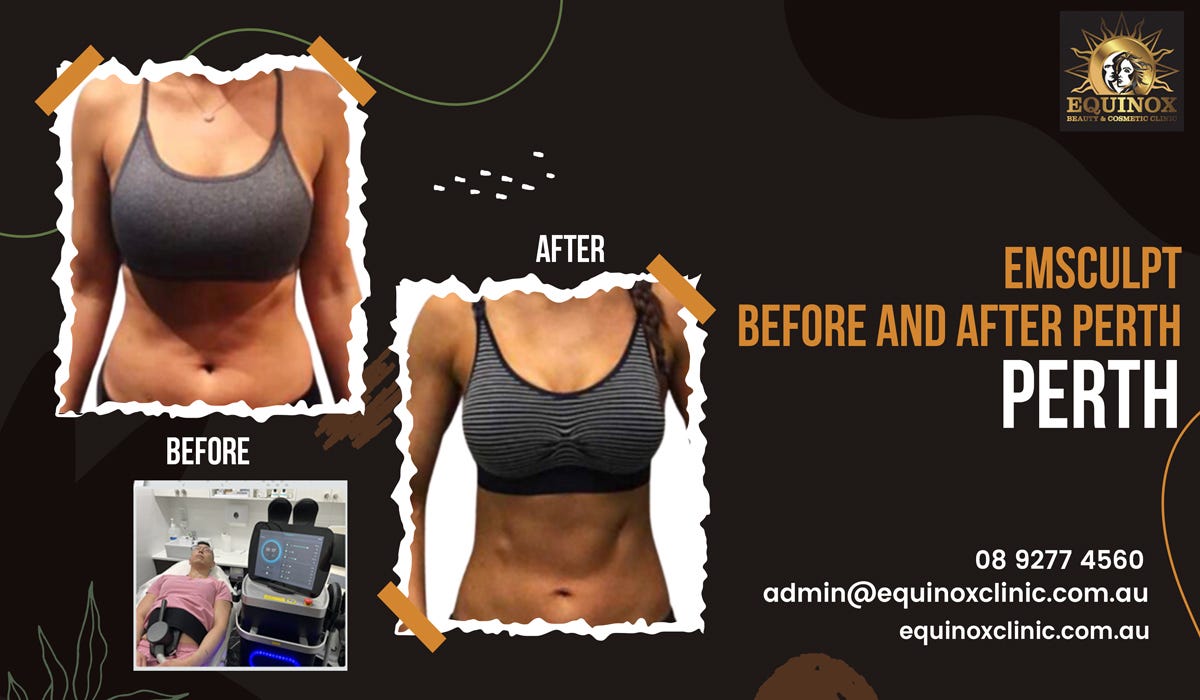 What To Expect From The Emsculpt Procedure Before And After By Equinox Beauty And Cosmetic