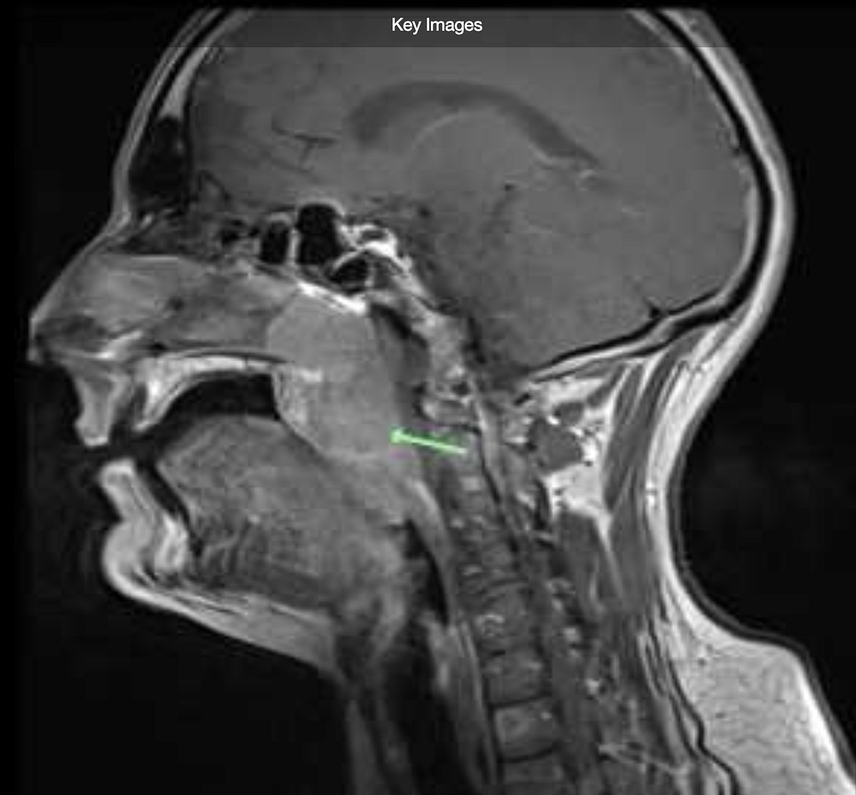 I have cancer. At 12:33 on the 4th of January 2019 my… | by David ...