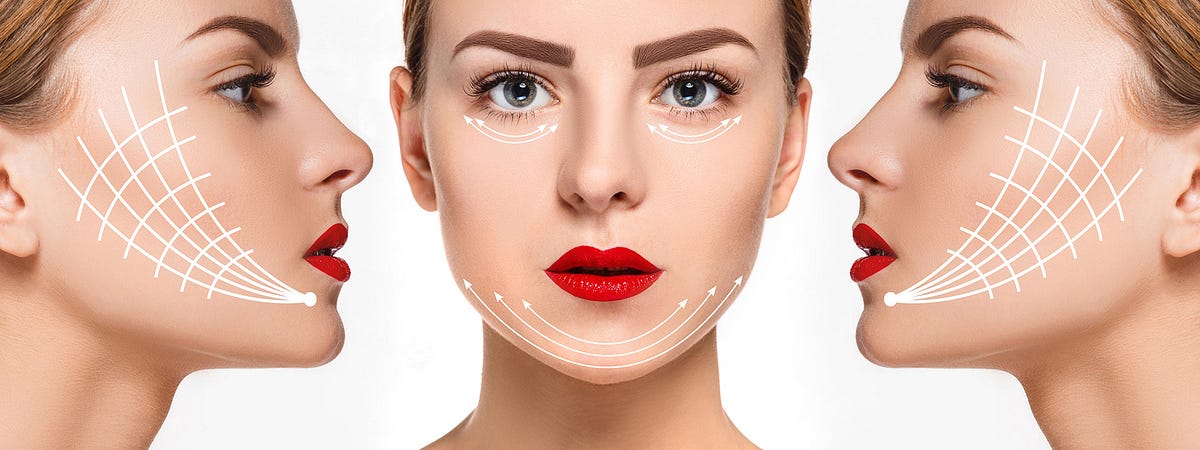 special Thread Lift. The Thread Lift procedure offers an… | by jack ...