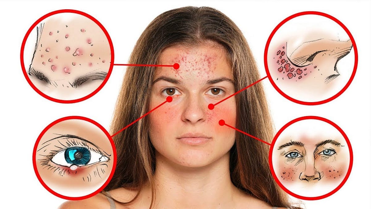 5 Things your face can tell you about deep health problems | by Susan ...