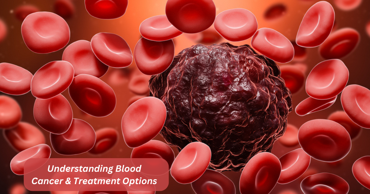 Understanding Blood Cancer & Treatment Options | by Mahimaavarun | Medium