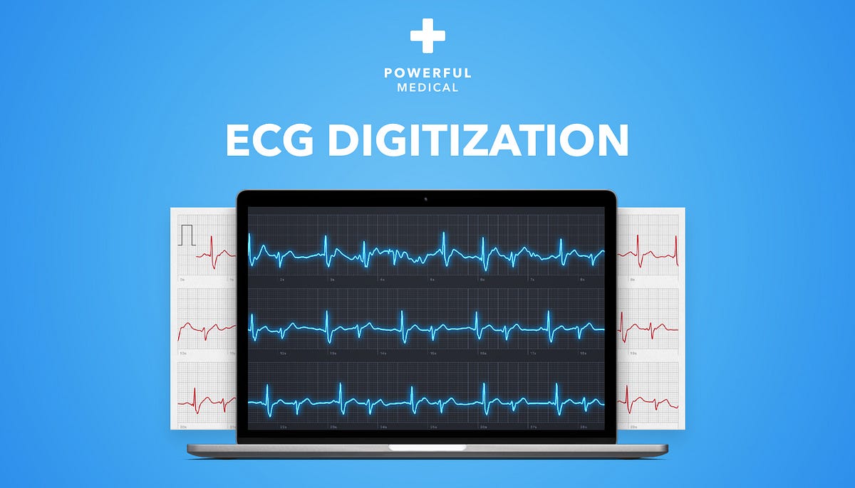 Ecg Digitization System A Generalised Solution For Greater By Robert Herman Powerful