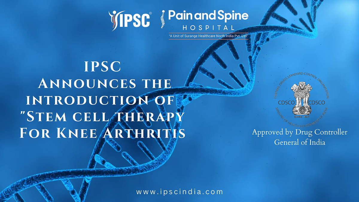 Stem cells: A promising innovation in the treatment of Osteoarthritis ...
