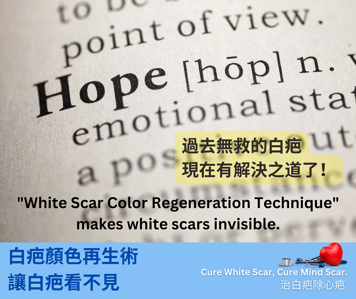 International Scar Specialist, how should I deal with my white scars ...