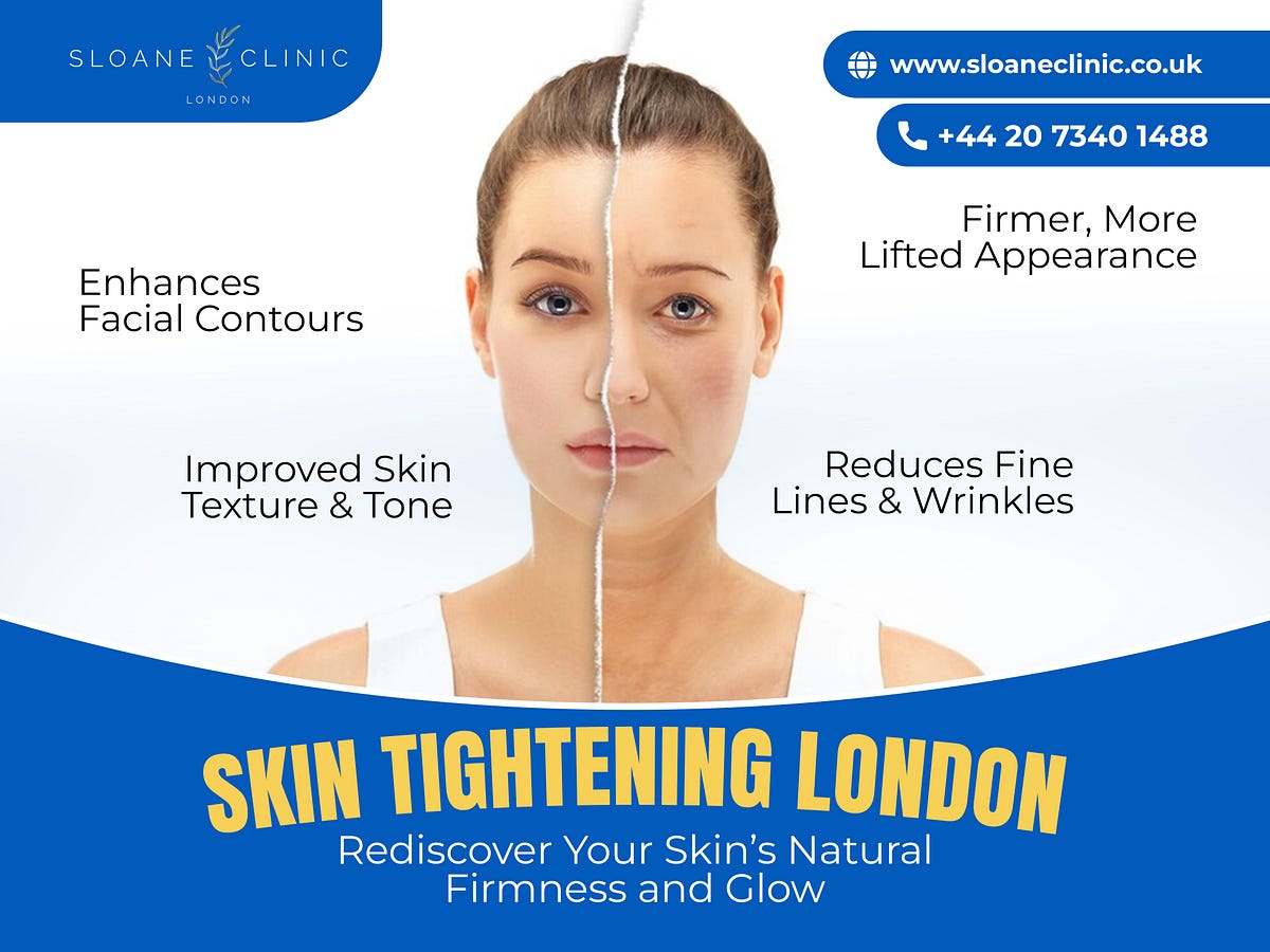 Advanced Skin Tightening in London! - Sloane Clinic - Medium