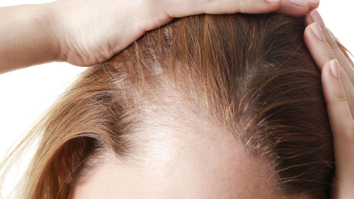 Unraveling the Strands. Understanding Hair Loss, Causes, and… | by I ...