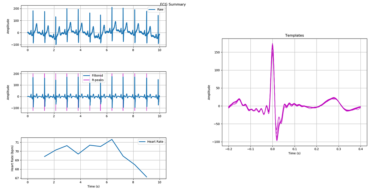 [HRV Analysis](python3) by pyHRV, BioSPPy | by Jimmy Yeh | Medium