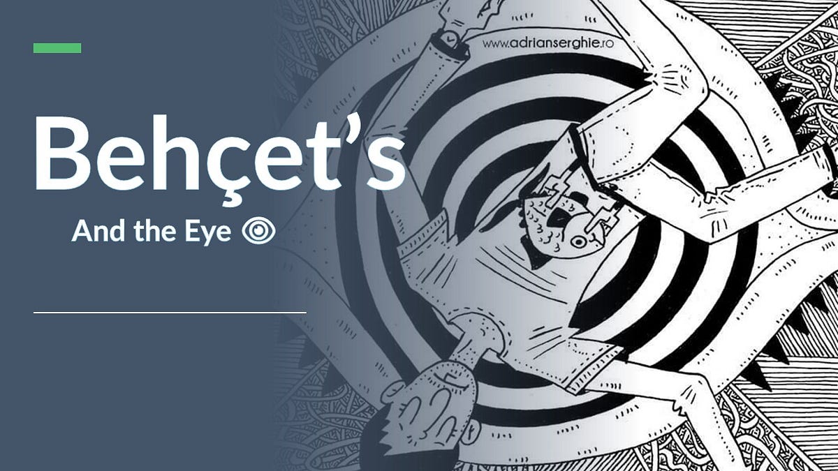 Behçet’s Disease and the Eye. Understanding the Impact on Vision and ...