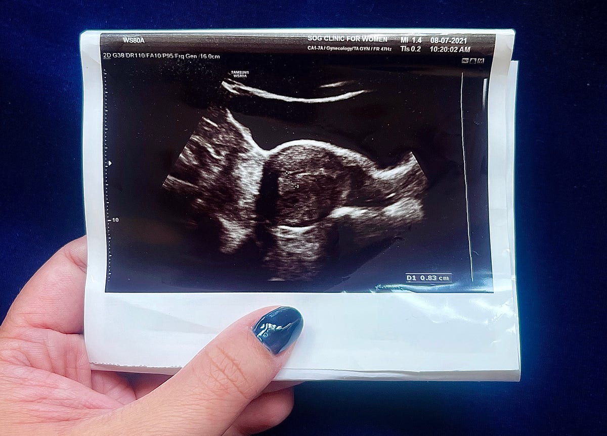 The line between a child being a blessing or a burden is extremely thin. | by Joanne Jonk Kwok ...