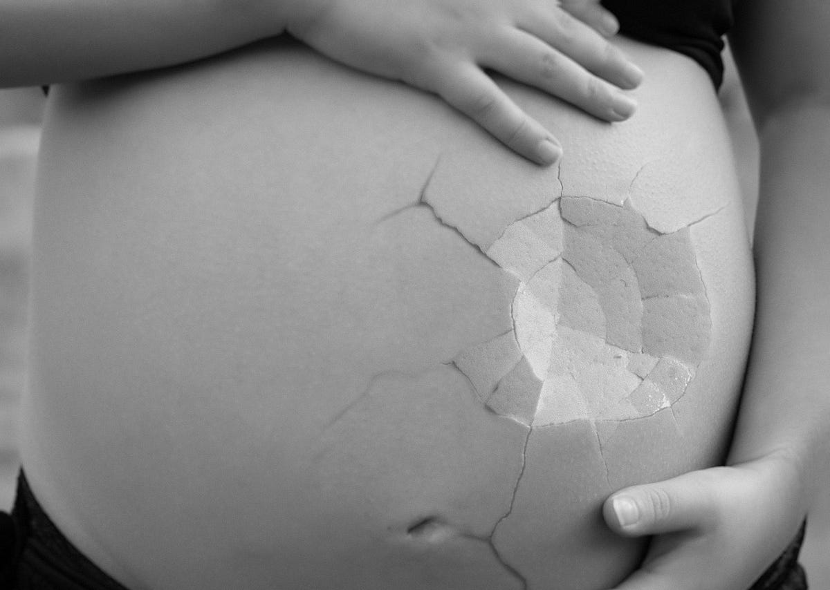 Understanding Different Types Of Miscarriage | by Aecia | Sep, 2023 ...