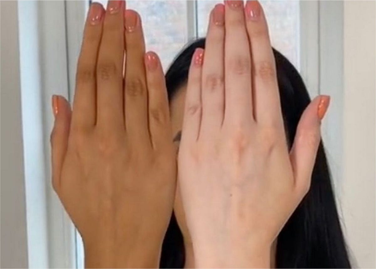 How to remove tan from hands immediately | by DERMATOUCH | Medium