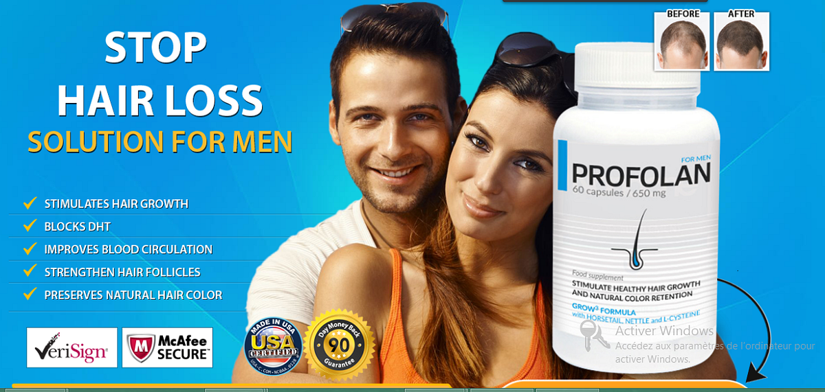 Profolan Hair Loss Review. Is it normal to lose this much hair… | by ...