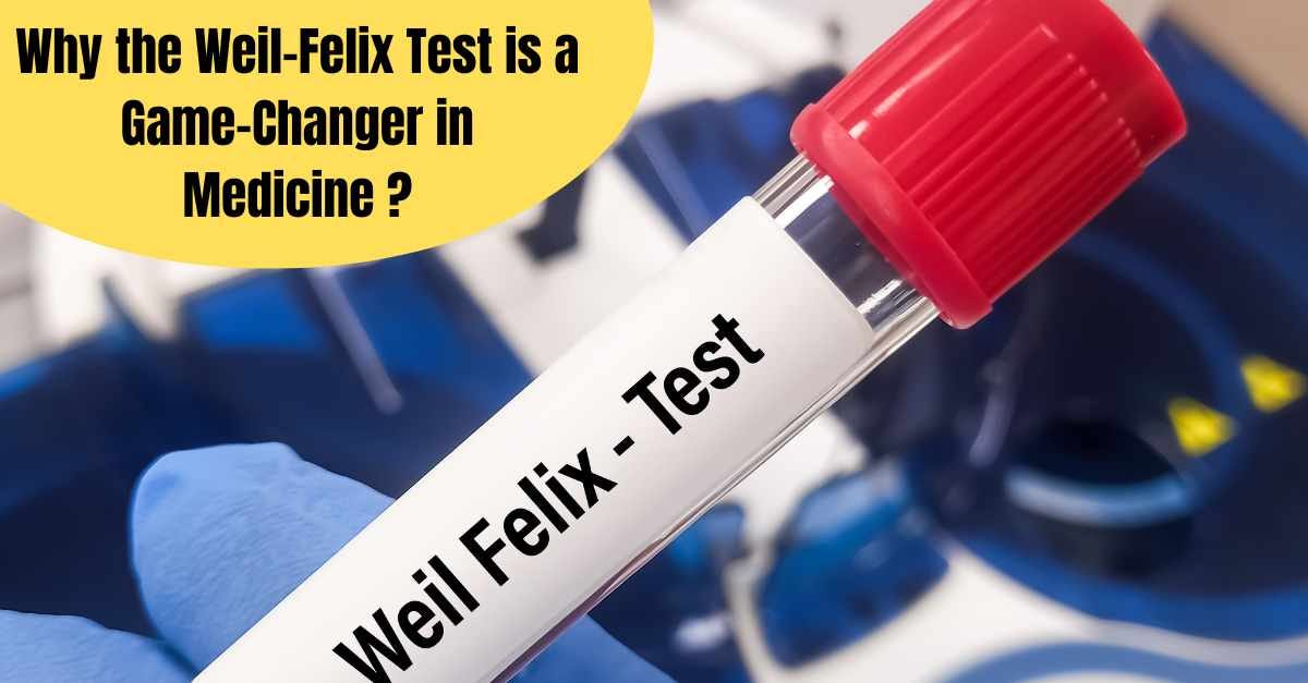 Weil Felix Test — Marvel Path Lab | by Marvel Path Lab | Medium