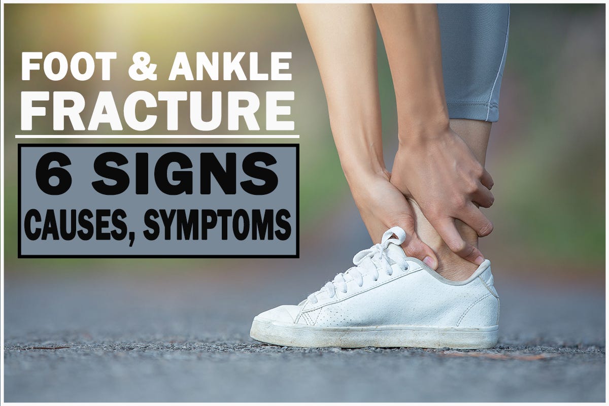 6 Signs of Foot and Ankle Fractures: Causes and Symptoms | by ...
