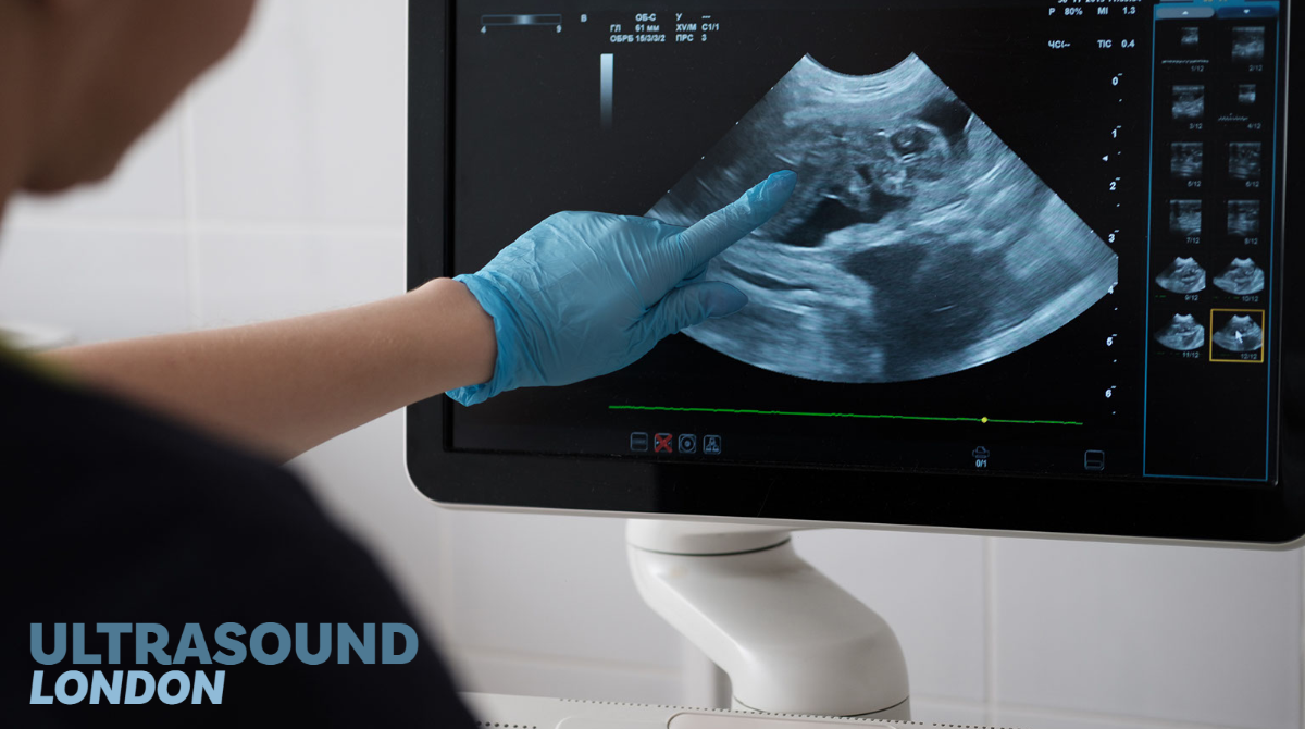 How To Get Better Baby Scans In London | by Sharon | Medium