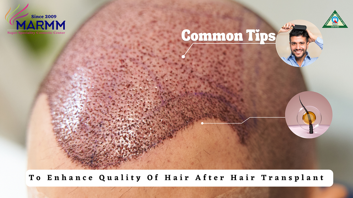 Common Tips To Enhance Quality Of Hair After Hair Transplant | by ...