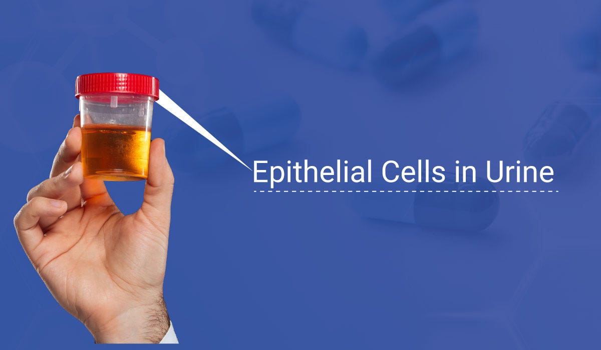 What Epithelial Cells In Urine Can Tell You | by Saketnarnoliurologist ...
