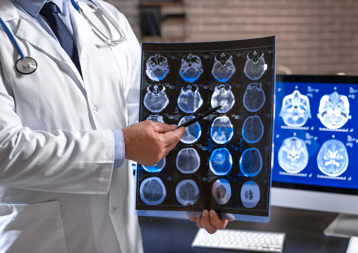 CNN in Medicine: Visualising an AI-powered Brain Tumour Detector 🧠 | by ...