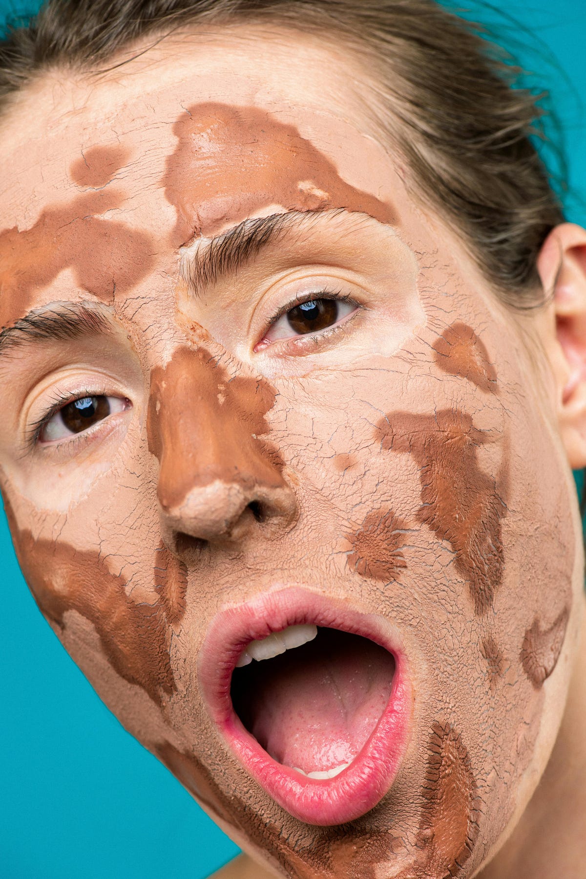 “Natural” Skincare Gave Me Chemical Burns That Dermatology Couldn’t Fix ...