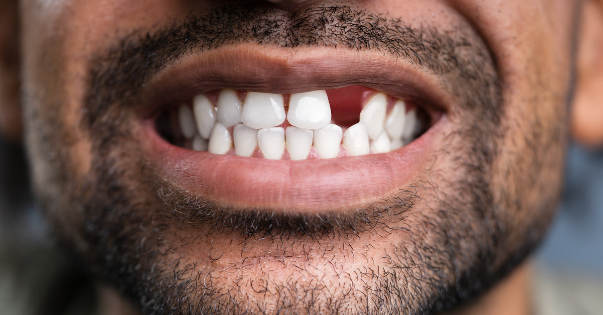 When Your Bumble Date is Missing a Tooth | by Ashley Neale | Bouncin ...