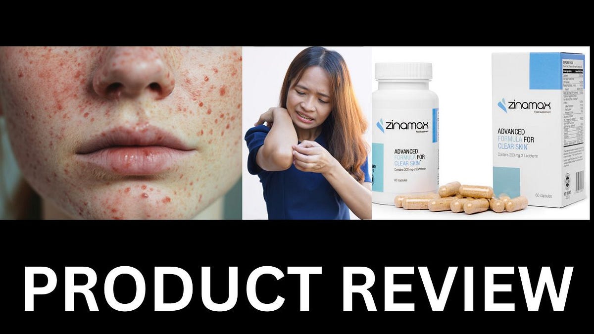 PRODUCT REVIEW Zinamax Acne. ZinamaxAcne is a revolutionary skincare ...