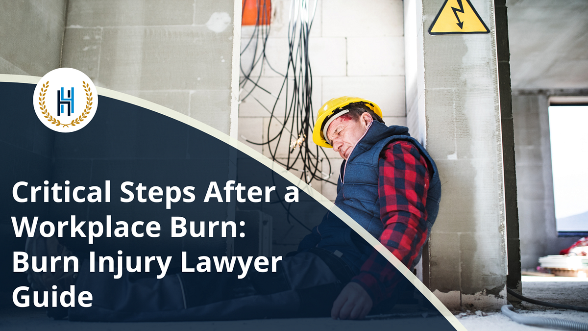 What to Do After Suffering a Burn Injury at Work: Immediate Steps and ...