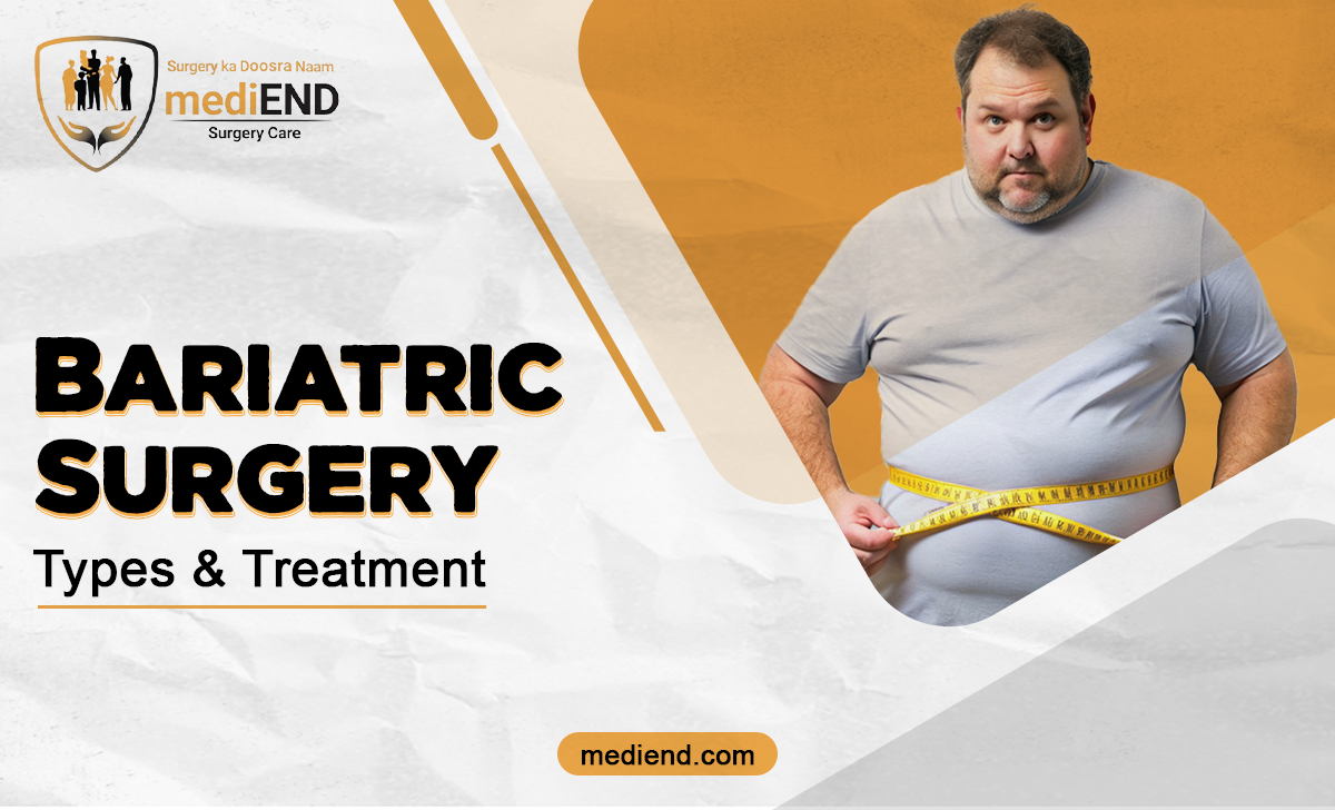 What Are the Different Types of Bariatric Surgery? | by mediend | Oct ...