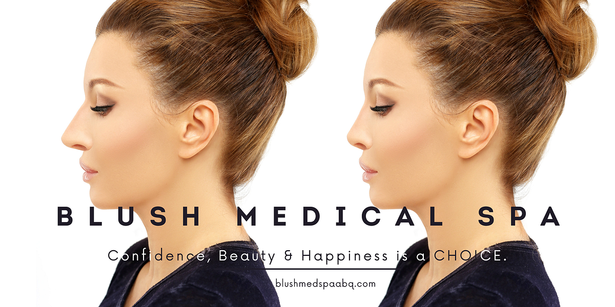 Liquid Rhino: Turn up your nose without surgery | by Blush Medical Spa ...