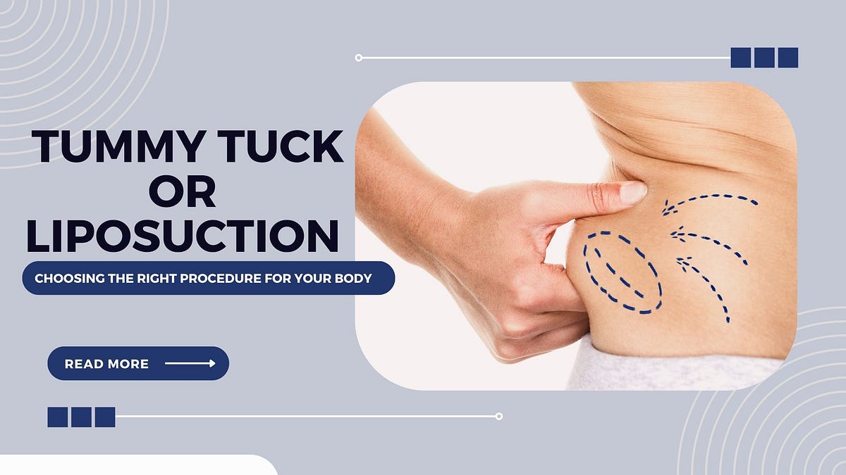 Tummy Tuck or Liposuction: Choosing the Right Procedure for Your Body ...