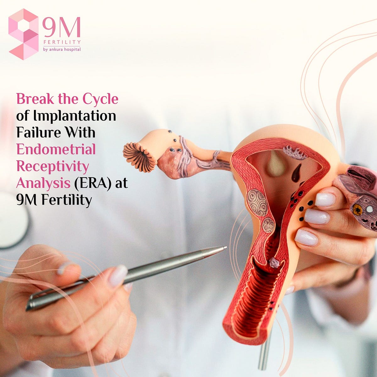 Endometrial Receptivity Analysis (ERA) at 9M Fertility - 9M Fertility - Gachibowli, Pune - Medium