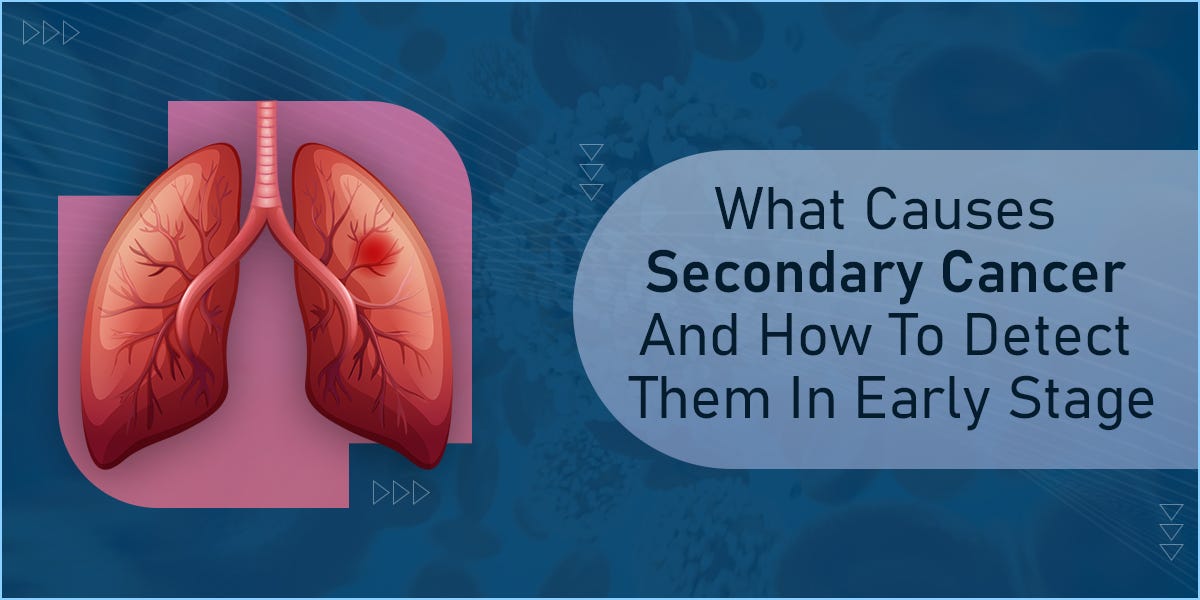WHAT CAUSES SECONDARY CANCER AND HOW TO DETECT THEM IN EARLY STAGE - Dr ...