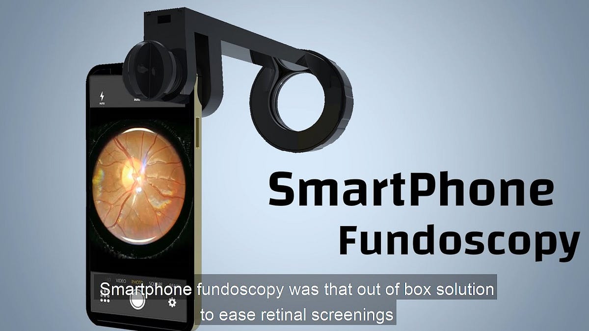 Fundus Examination: Unveiling the Secrets of Ocular Health | by ...