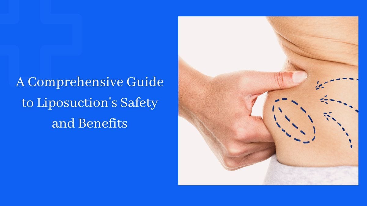 A Comprehensive Guide to Liposuction’s Safety and Benefits | by Eterna Vision & Aesthetics | Jun ...