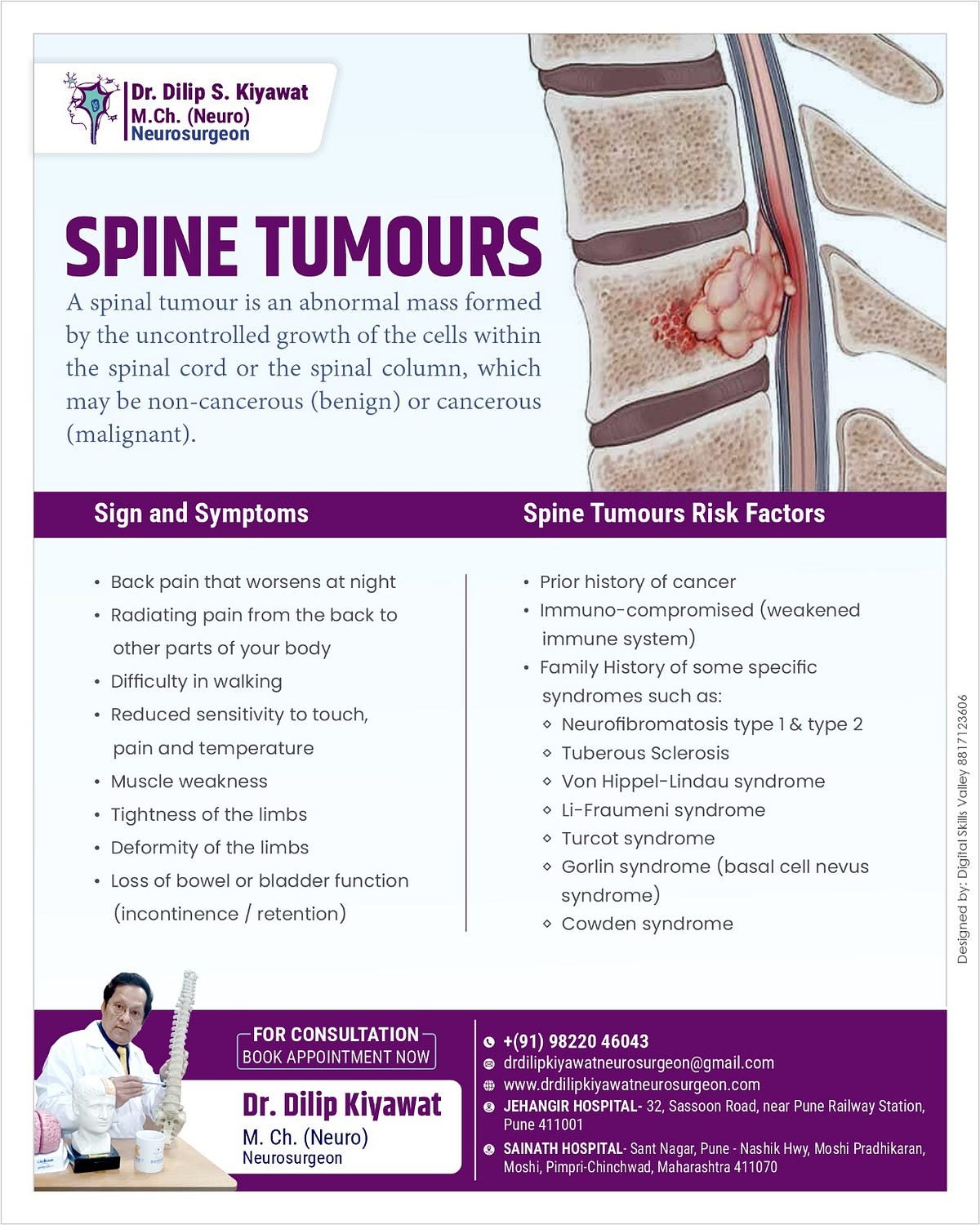 Worried about spine tumors? Know the signs & risk factors - Dr. Dilip ...