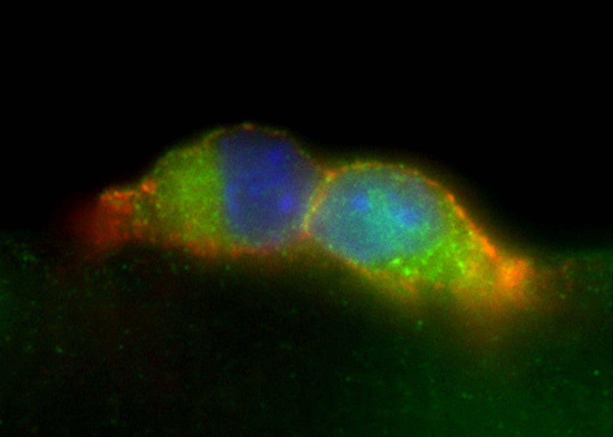 Muscular dystrophy research is getting directions from lost muscle stem ...