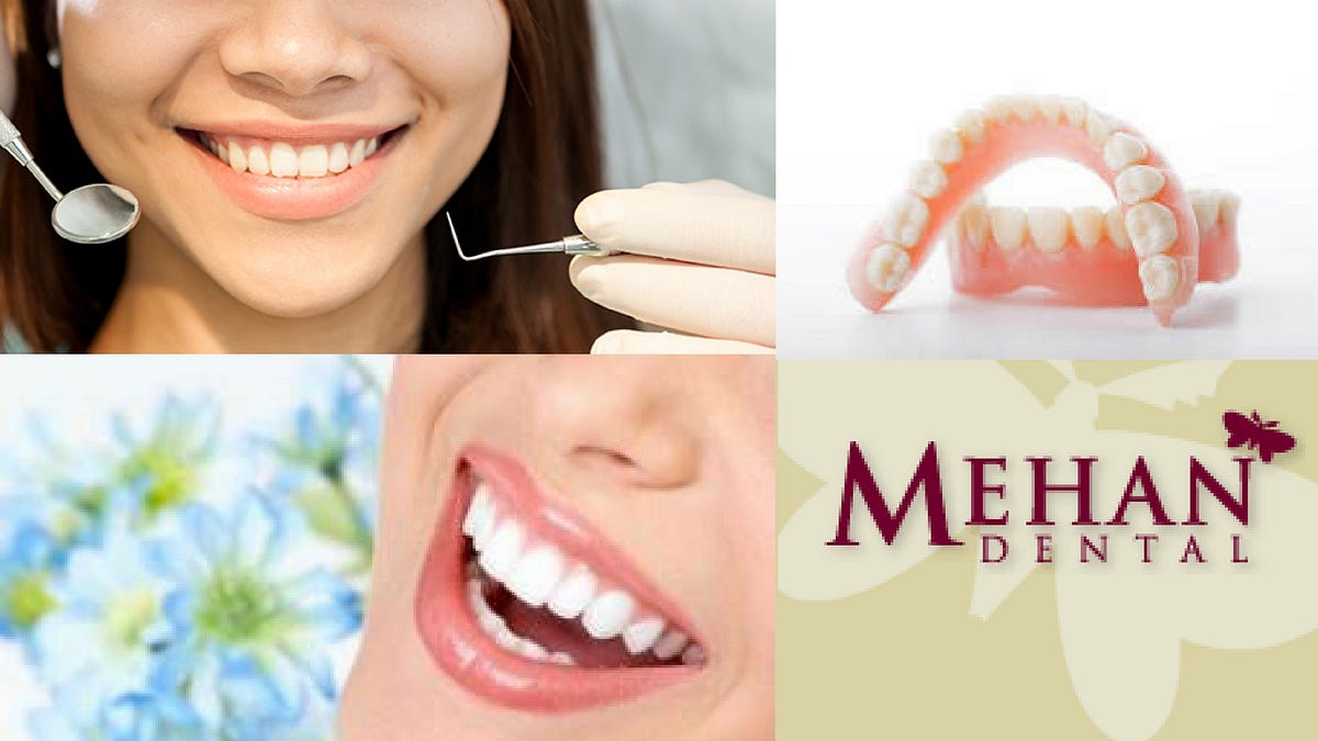 Different Tips to Look for The Perfect Dentist | by Mehan Dental | Medium