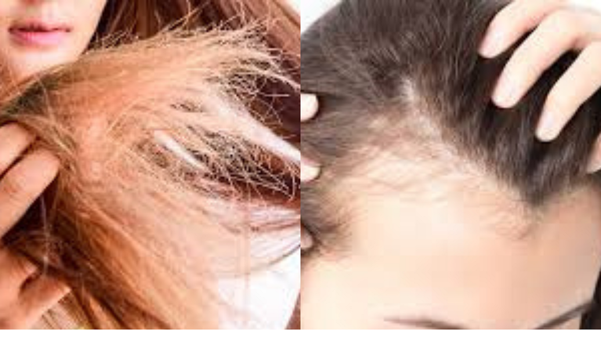 How to know if hard water is damaging your hair? | by Dr. Aitzaz Ahsan ...