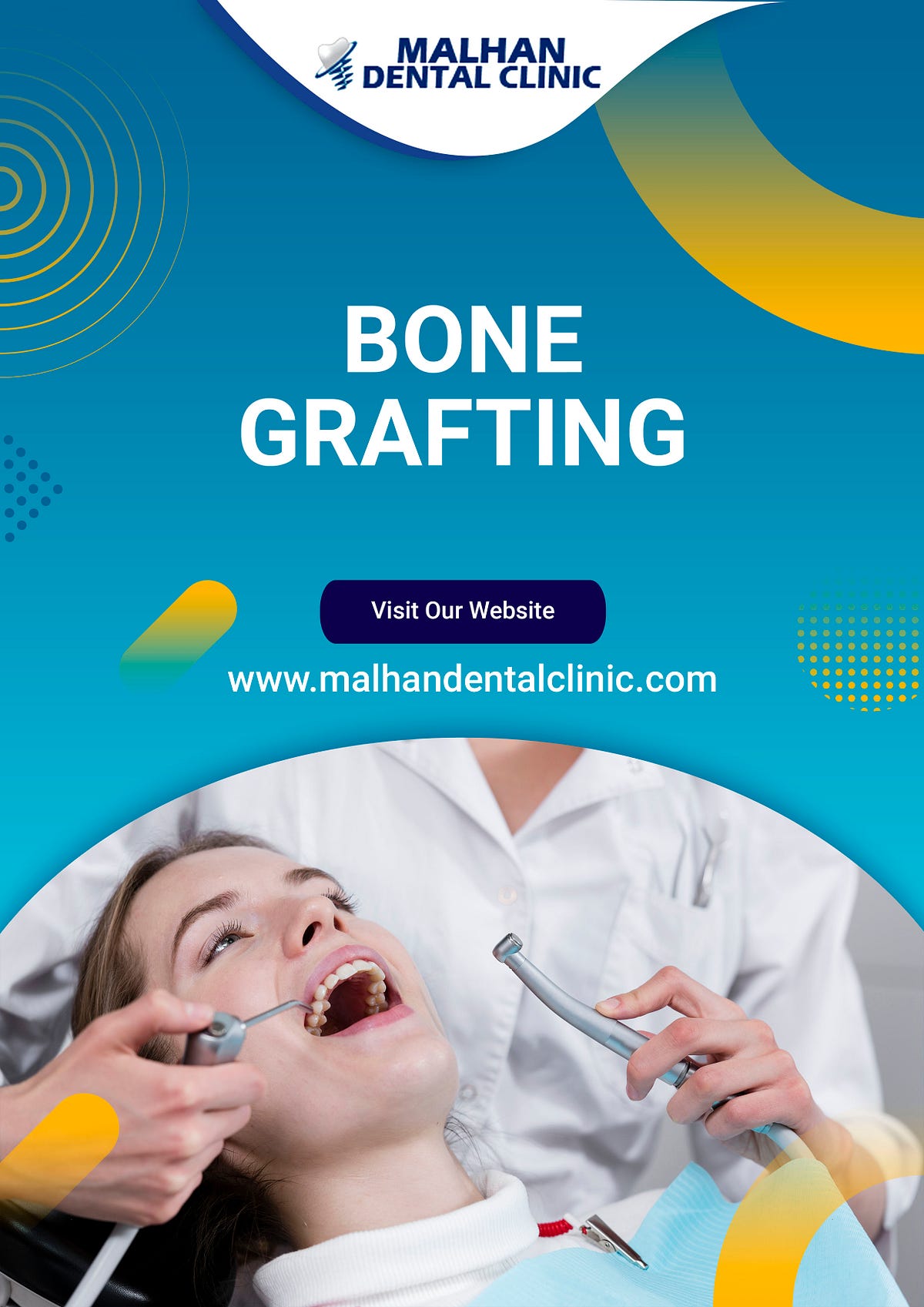 Dental Bone Grafting Treatment Jalandhar | Bone Grafting Treatment | by ...